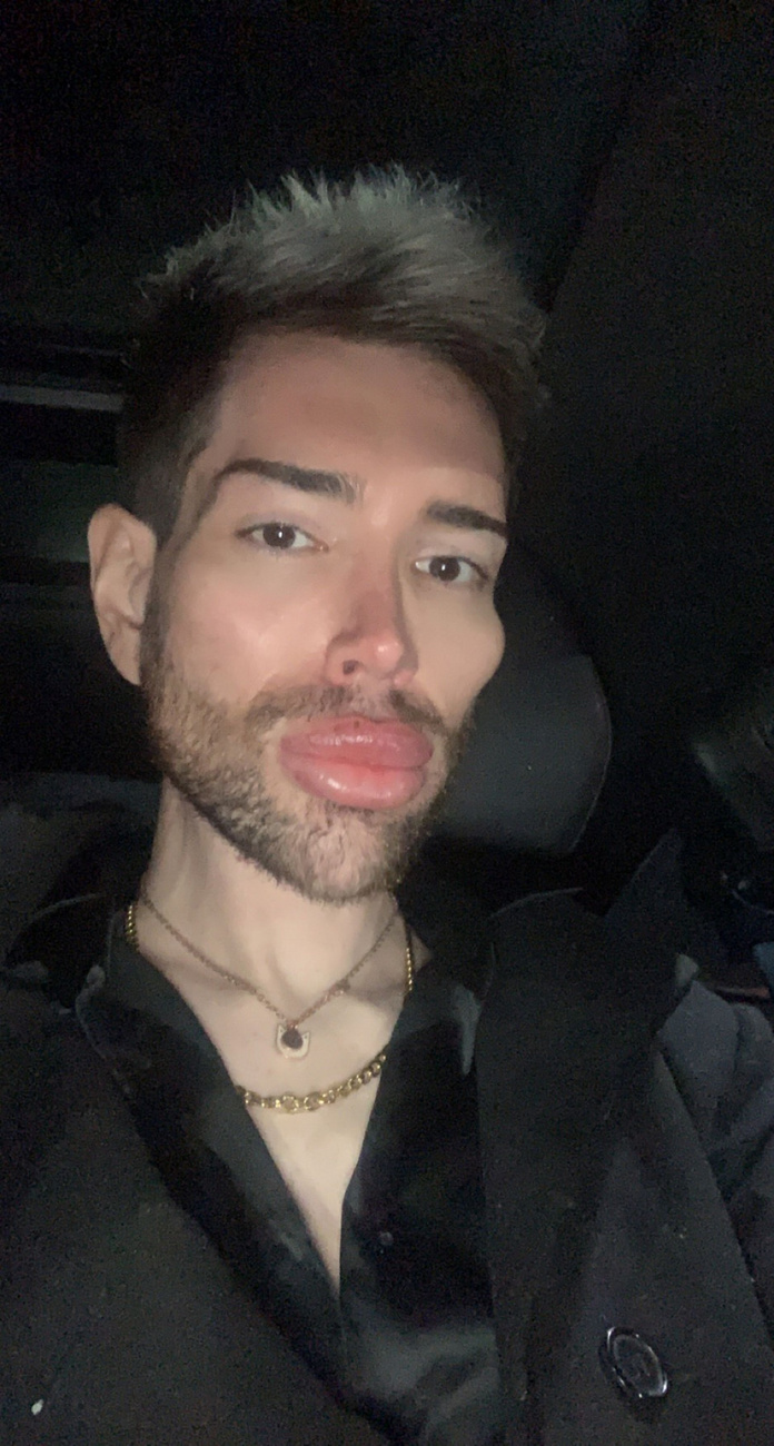 Index – Teljesen átszabatta arcát az élő Ken baba – Galéria